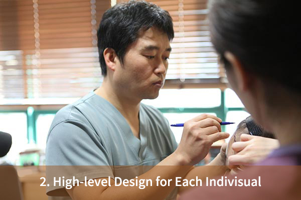 Hairline correction - Maxwell Hair Clinic